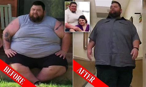 This Morbidly Obese Man Became Addicted To Sleep After Undergoing This Morbidly Obese Man Became Addicted To Sleep After Undergoing