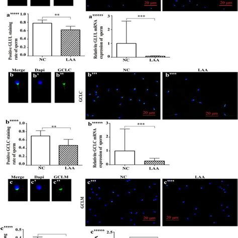 Intracellular Locations And Protein Mrna Expression Of Glul Gclc Gclm