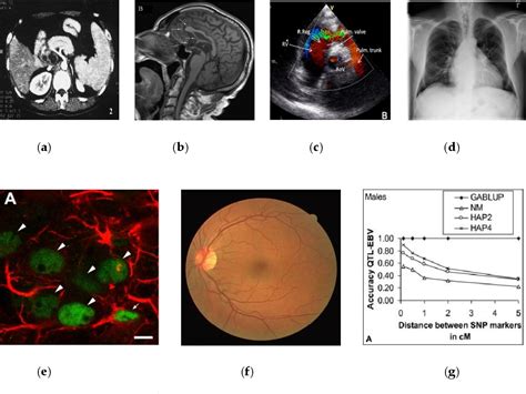 Figure 1 From Visual Interpretation Of Convolutional Neural Network Predictions In Classifying
