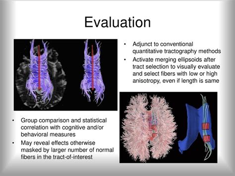 Visualizing Diffusion Tensor Imaging Data With Merging Ellipsoids Ppt