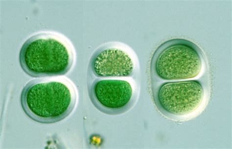 Prokaryote Chroococcales Chroococcus Turgidus