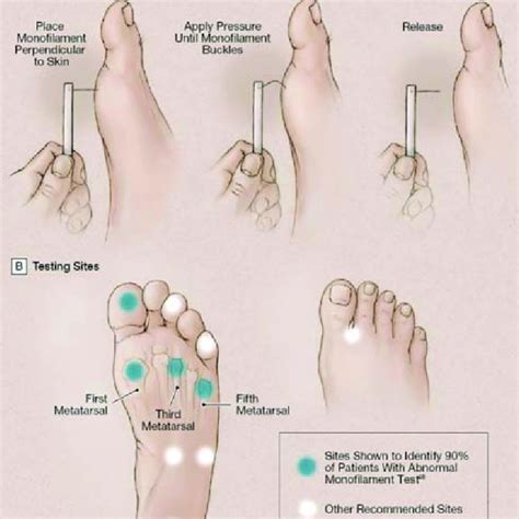 Monofilament Test For Light Touch Sensation Download Scientific Diagram Monofilament Test For Light Touch Sensation Download Scientific Diagram