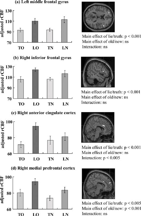 Table 1 From Neural Correlates Of Deception Semantic Scholar