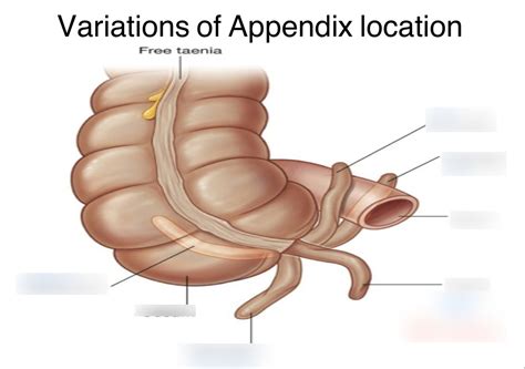 Appendix Locations And Other Structures Diagram Quizlet