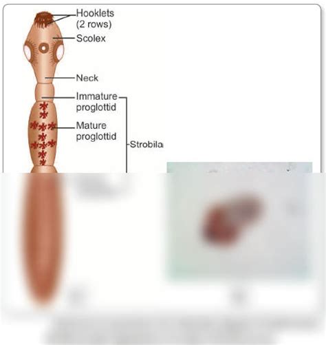 Solution Cestodes Cyclophyllidea Echinococcus Granulosus Morphology