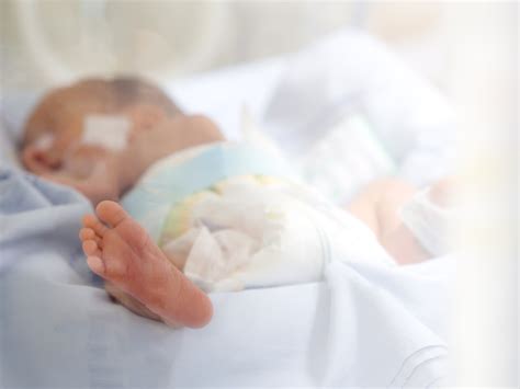 The Longterm Impact Of A Patent Ductus Arteriosus On Preterm Infants