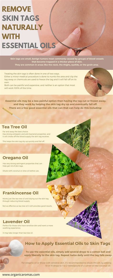Remove Skin Tags Naturally With Essential Oils Artofit