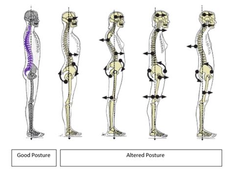 Posture Class Lifesharing