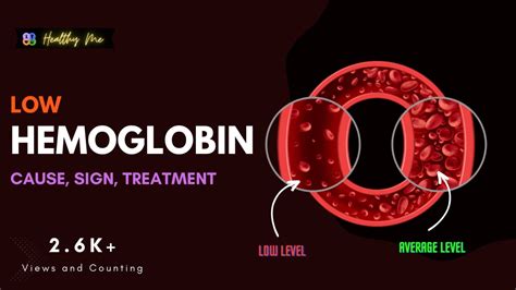 Antibiotics Cause Low Hemoglobin At Troy Haynes Blog