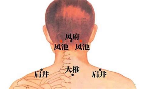 颈椎病这种情况必须看医生！否则专家也帮不了你！ 颈椎病 新浪新闻
