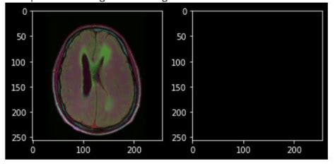 Web3byts On Linkedin Segmenting Brain Mri Images Using Python
