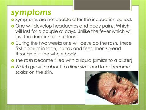 Smallpox Symptoms