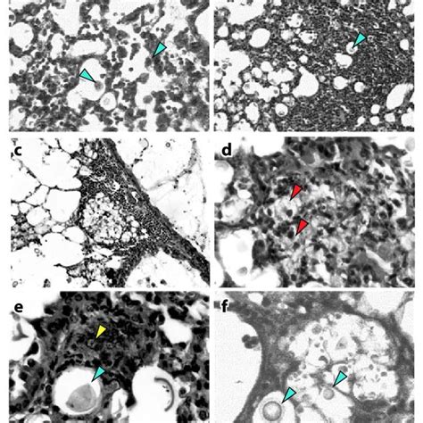 Transmission Electron Micrographs Showing Cryptococcus Neoformans And