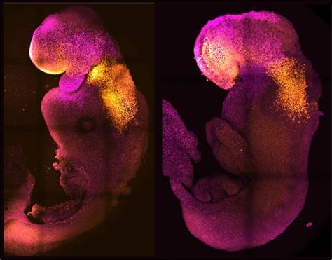 “synthetic” Mouse Embryo With Brain And Beating Heart Grown From Stem Cells
