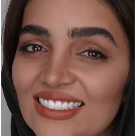 لمینت و کامپوزیت خوب در مشهد دکتر وکیلی Youtube