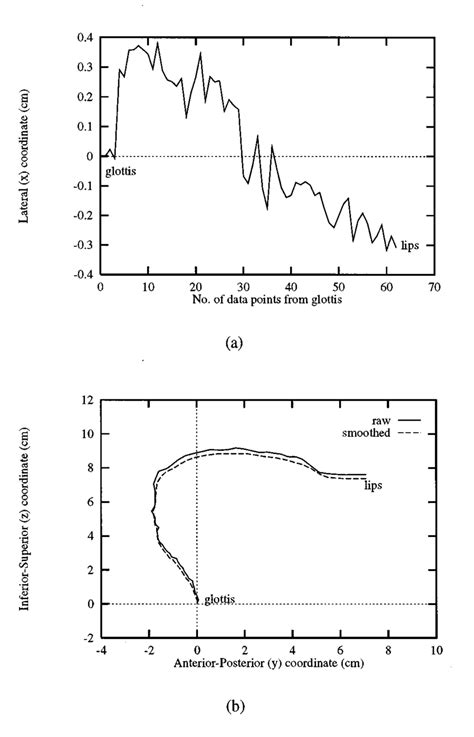 Off Axis Variations Of The Vocal Tract Centerline A Lateral X