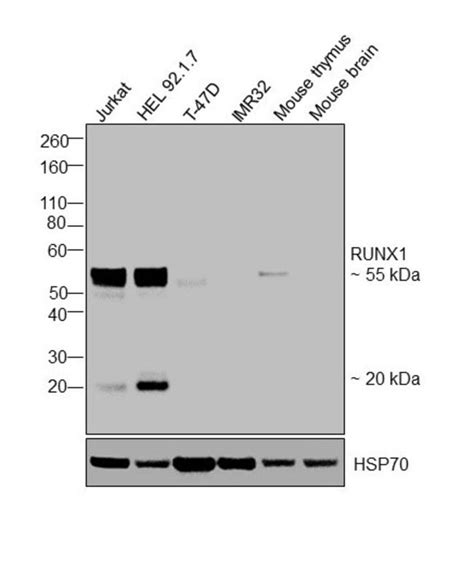 RUNX1 Polyclonal Antibody Invitrogen 100 μg Unconjugated Antibodies Fisher Scientific