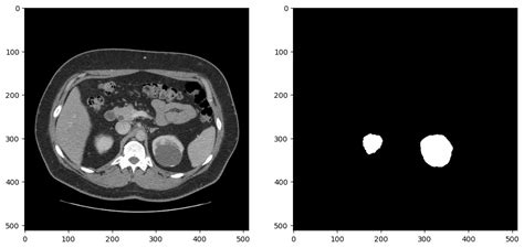 Quantize A Segmentation Model And Show Live Inference — Openvino™ Documentation