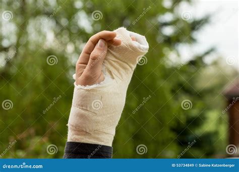 Arm In Plaster Stock Image Image Of Cast Body Broken 53734849