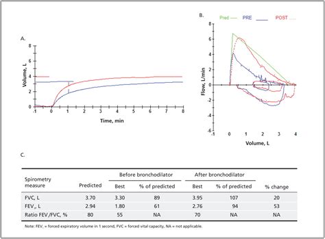 Spirometry Graph At Douglas Hammond Blog Spirometry Graph At Douglas Hammond Blog