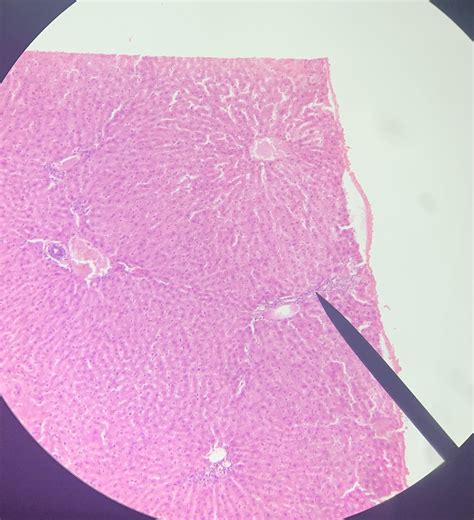 Liver Diagram Quizlet