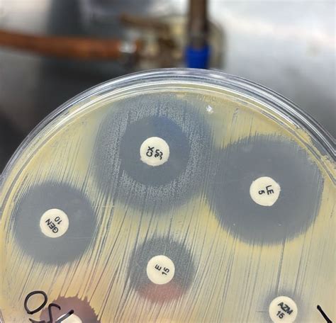 Majida P On Linkedin Cefoxitin Is Used As A Surrogate Marker In Antimicrobial Susceptibility