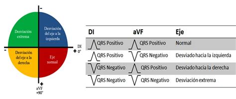 Tutomedic Rutina De InterpretaciÓn Del Ecg3 Eje De Qrs