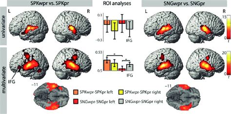 1 Brain Regions That Distinguish Between Words And Pitch Rhythm Download Scientific Diagram