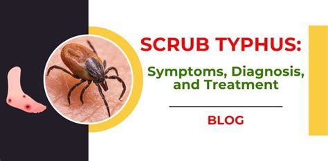 Explore Scrub Typhus Symptoms Diagnosis And Treatment