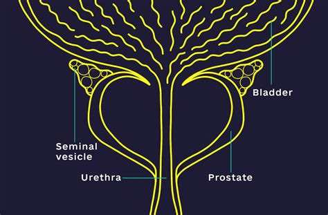 Prostatitis Types Causes And When To Seek For Help