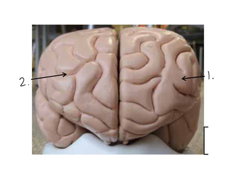 Re Do Biol 105 Lab Exam Brain 1 Diagram Quizlet