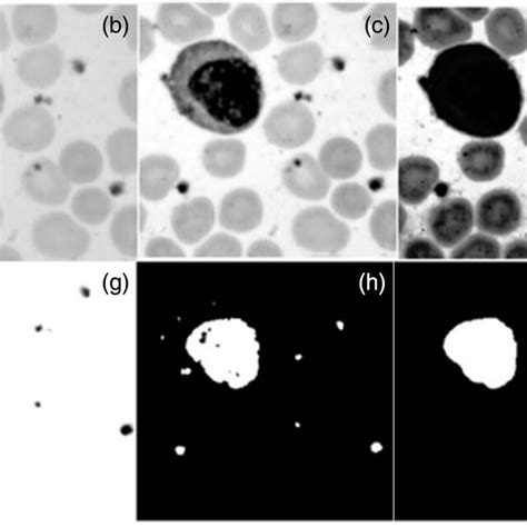 Intermediate Results Of The Segmentation Process A Original RGB Blood Download Scientific