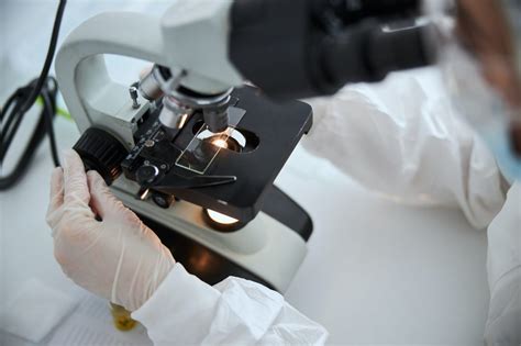 Establishing Gout Diagnosis Gout Education