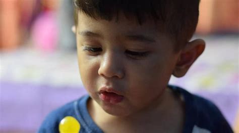 Streptococcus Strep A