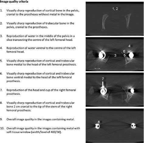 The Image Quality Criteria Used In The Visual Grading Evaluation Of The Download Scientific