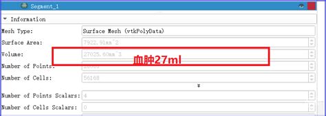 简单手术用心做 3d Slicer下基层硬膜外血肿篇 脑医汇