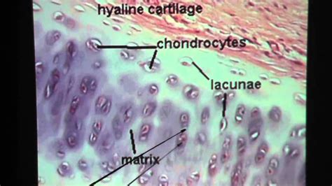 Components Of Hyaline Cartilage At Henry Gale Blog