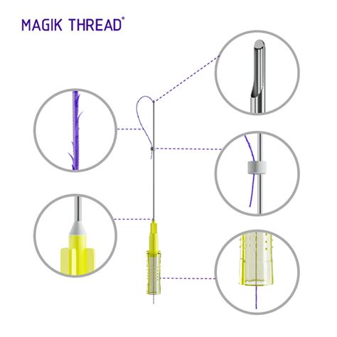 Pdo Thread Size Chart Choose The Right Needle Gauge And Length Dermax