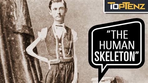 P T Barnums 10 Most Famous Human “freak” Show Attractions Youtube