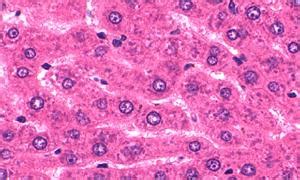 Arrayit Tissue Microarrays For Basic And Cancer Research Life Sciences Clinical And