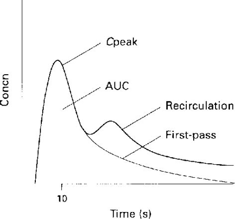 A Hypothetical Indicator Dilution Measurement Of Cardiac Output The Download Scientific