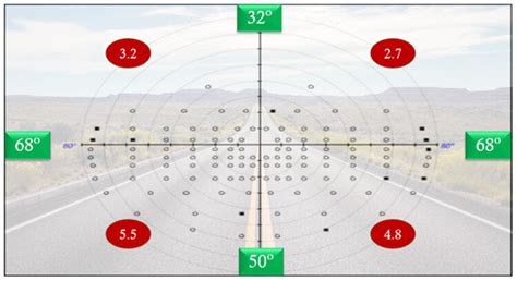 Example Of An Esterman Binocular Visual Field Test Printout Green Download Scientific Diagram