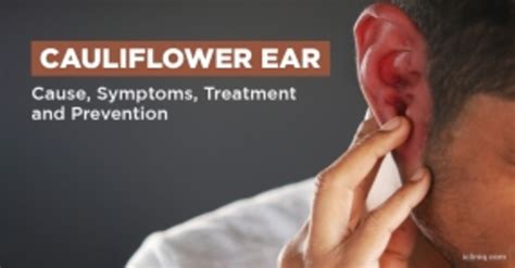 Health Articles In Cauliflower Ear