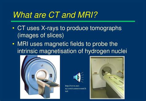 Ppt Applications Of Magnetic Resonance Imaging Mri And Computed Tomography Ct Powerpoint