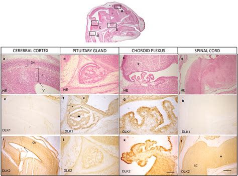 E16 5 Mouse Head Section Hande Stain Of The Cerebral Cortex A With The