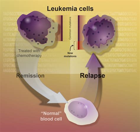 Leukemia Cell Diagram Molecular Alterations In Chronic Lymphocytic