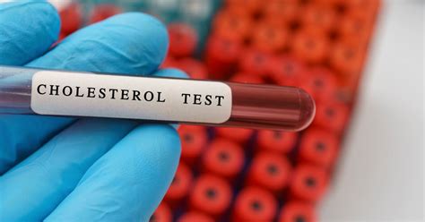 The Exact Cholesterol Numbers To Aim For According To A Cardiologist Parade