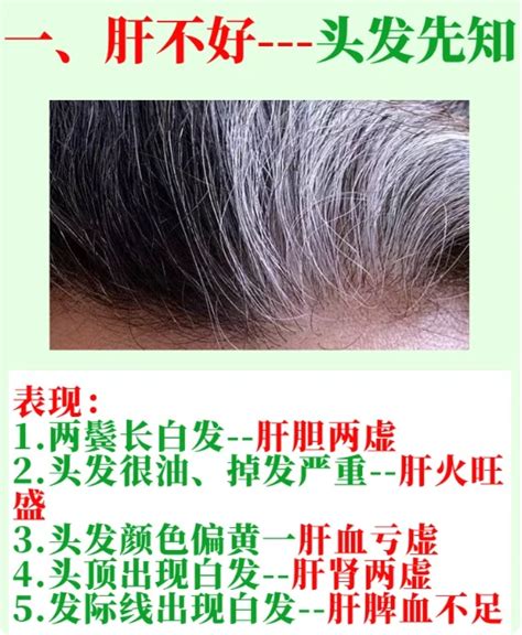 肝不好的五大表现 哔哩哔哩