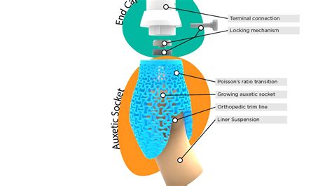 Orthoses And Prostheses — Rhino Grasshopper Open Access Education