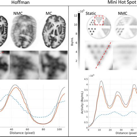 Comparison Of Phantoms Images From Static Non Motion Corrected And